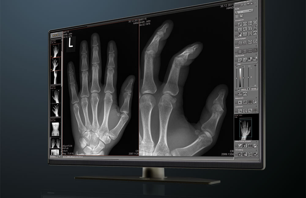 Digitales Röntgen | Röntgensysteme „Made in Germany“